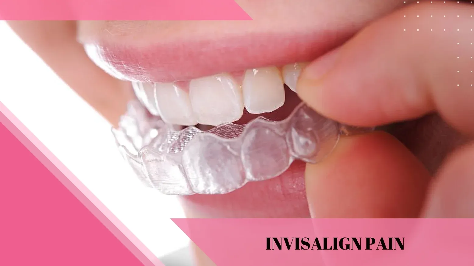 Does Invisalign Hurt? 6 Tips To Alleviate Invisalign Pain!