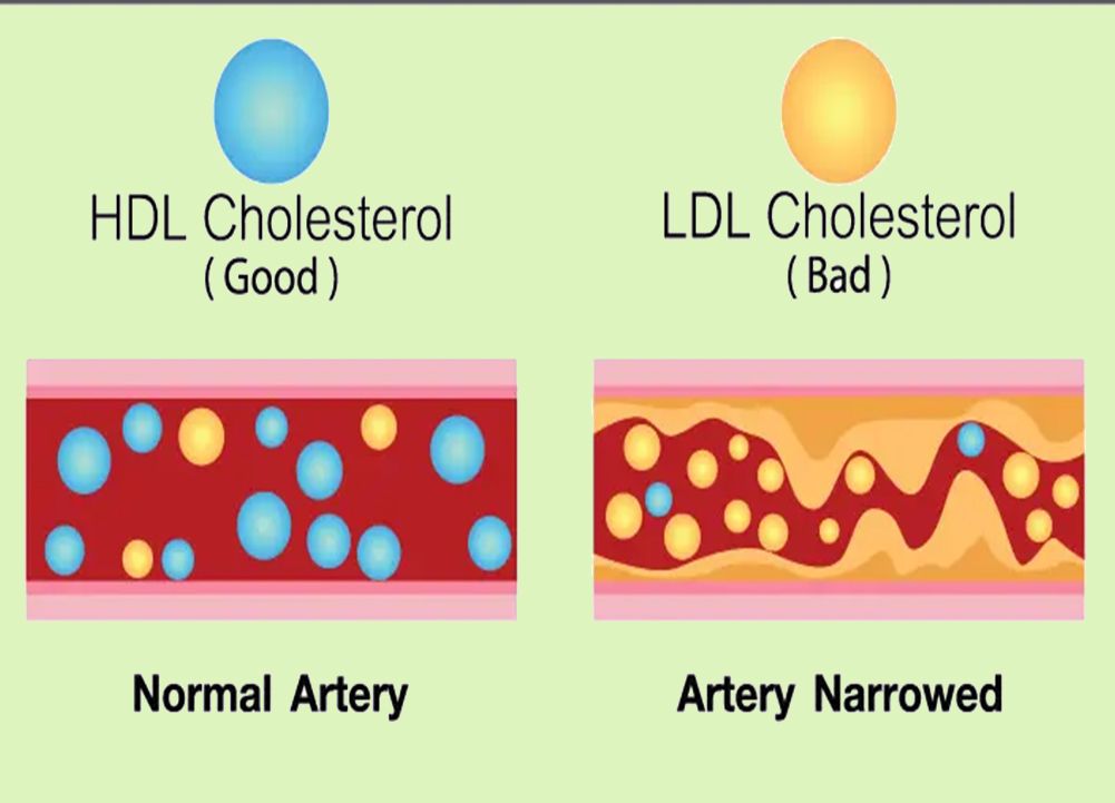 Good Vs Bad Cholesterol: What Are They?