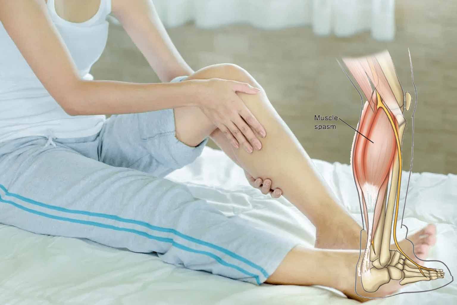 Muscle Cramps: Causes & Treatment