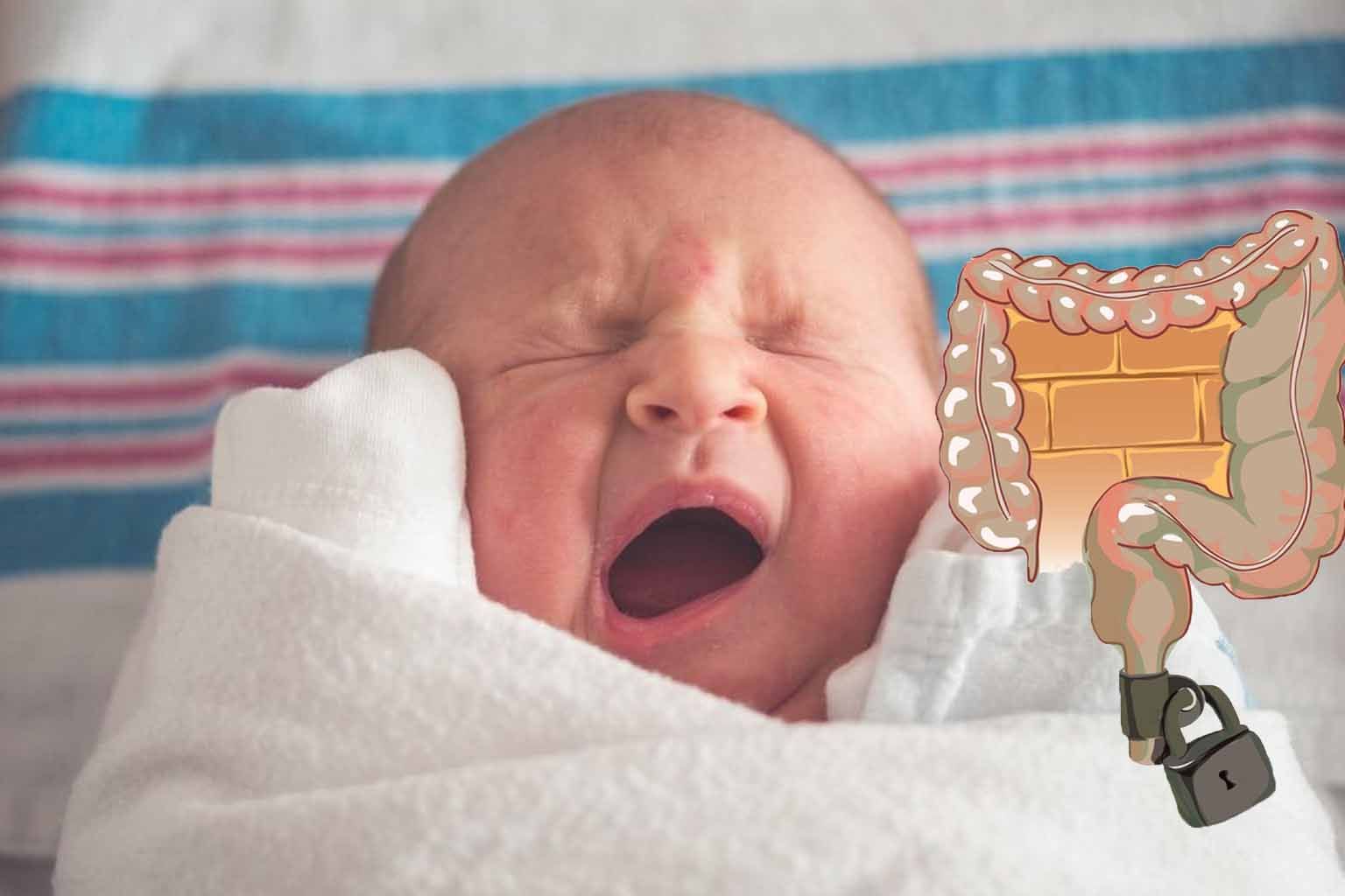 Constipation In Newborn: The Probable Causes